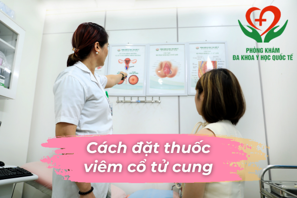 [BÁC SĨ HƯỚNG DẪN] Cách đặt thuốc viêm cổ tử cung chuẩn nhất